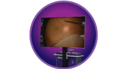 Advanced ULTRAVIT® Beveled High Speed Probe | Alcon Professional